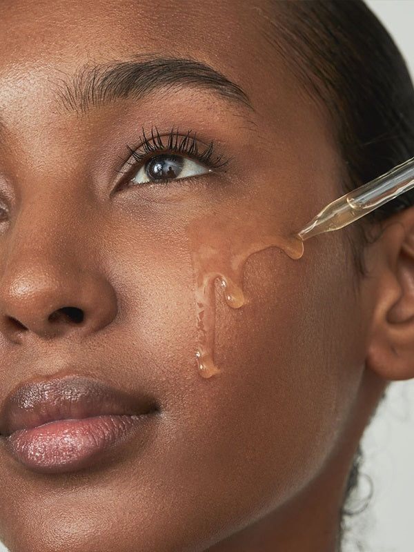 How to Manage Sebaceous Hyperplasia: Top Skincare Practices